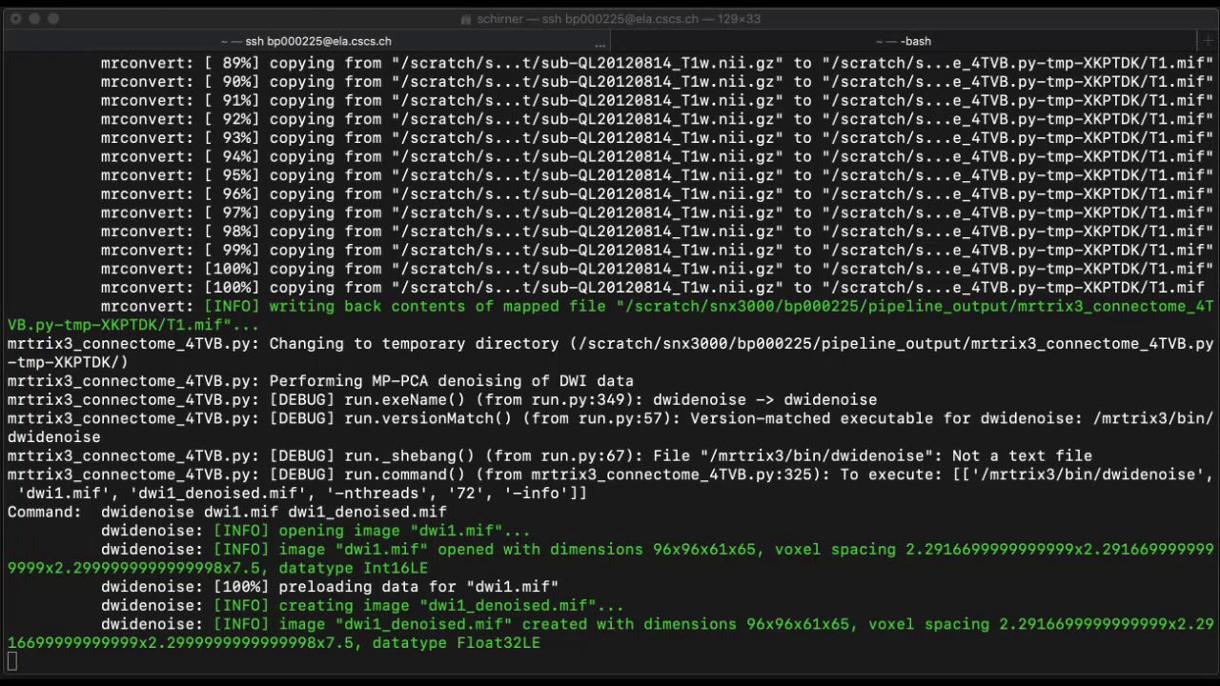 The Virtual Brain: LEARN: Human Brain Project (HBP) image processing pipeline for The Virtual Brain